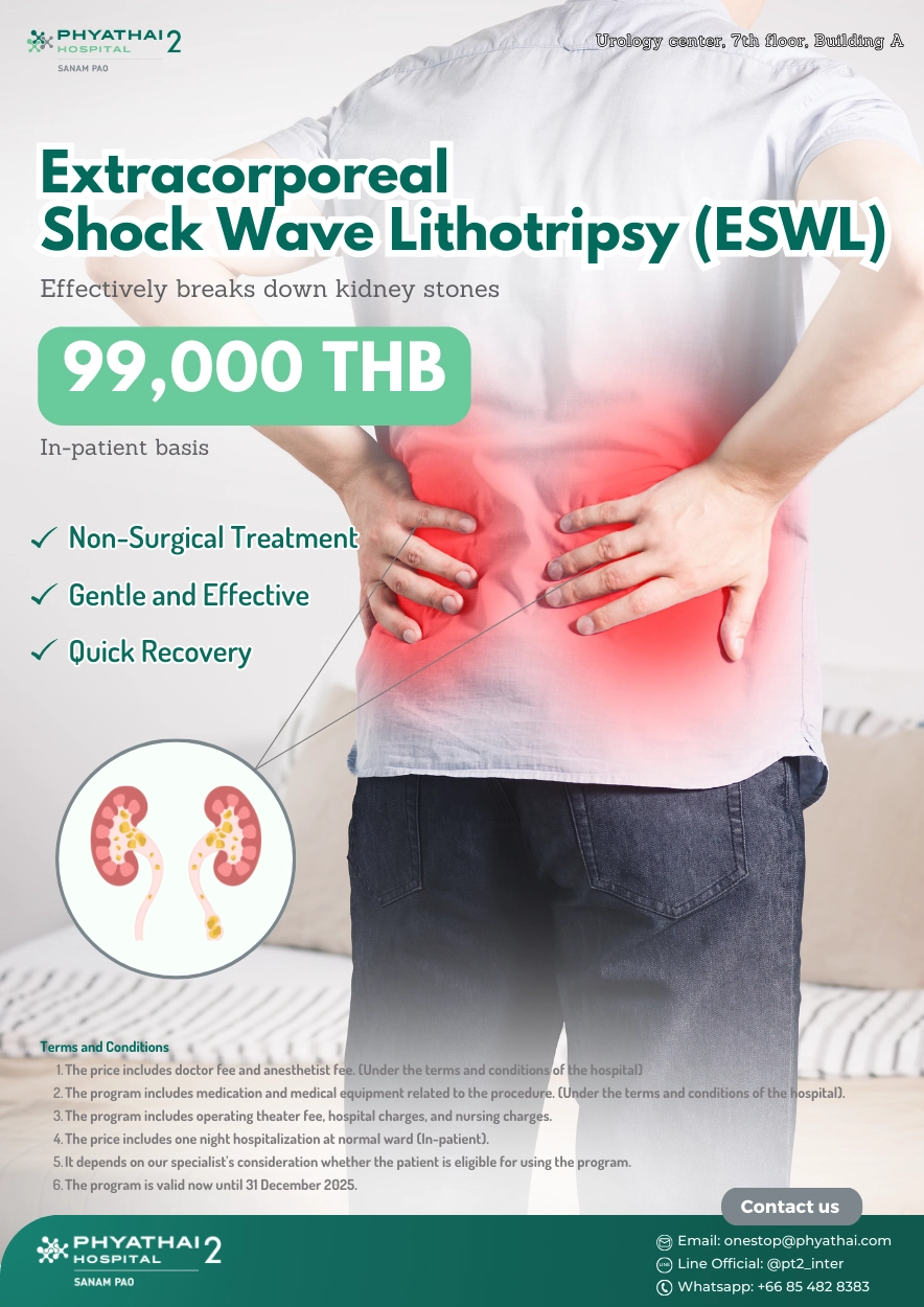 Extracorporeal Shock Wave Lithotripsy (ESWL) | Phyathai 2 Hospital ...