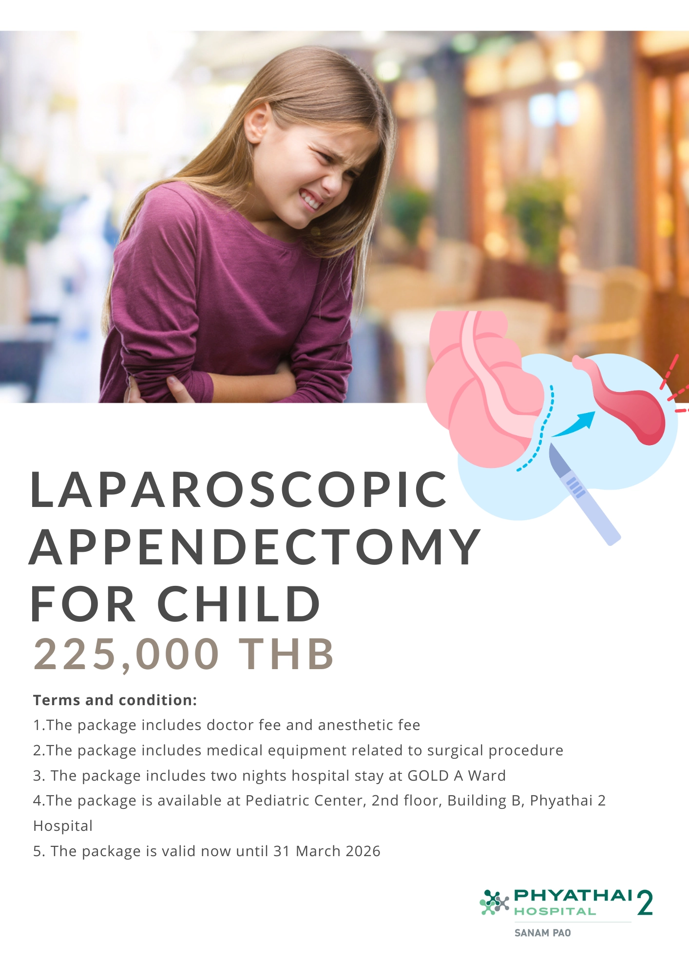 Laparoscopic Appendectomy for Children